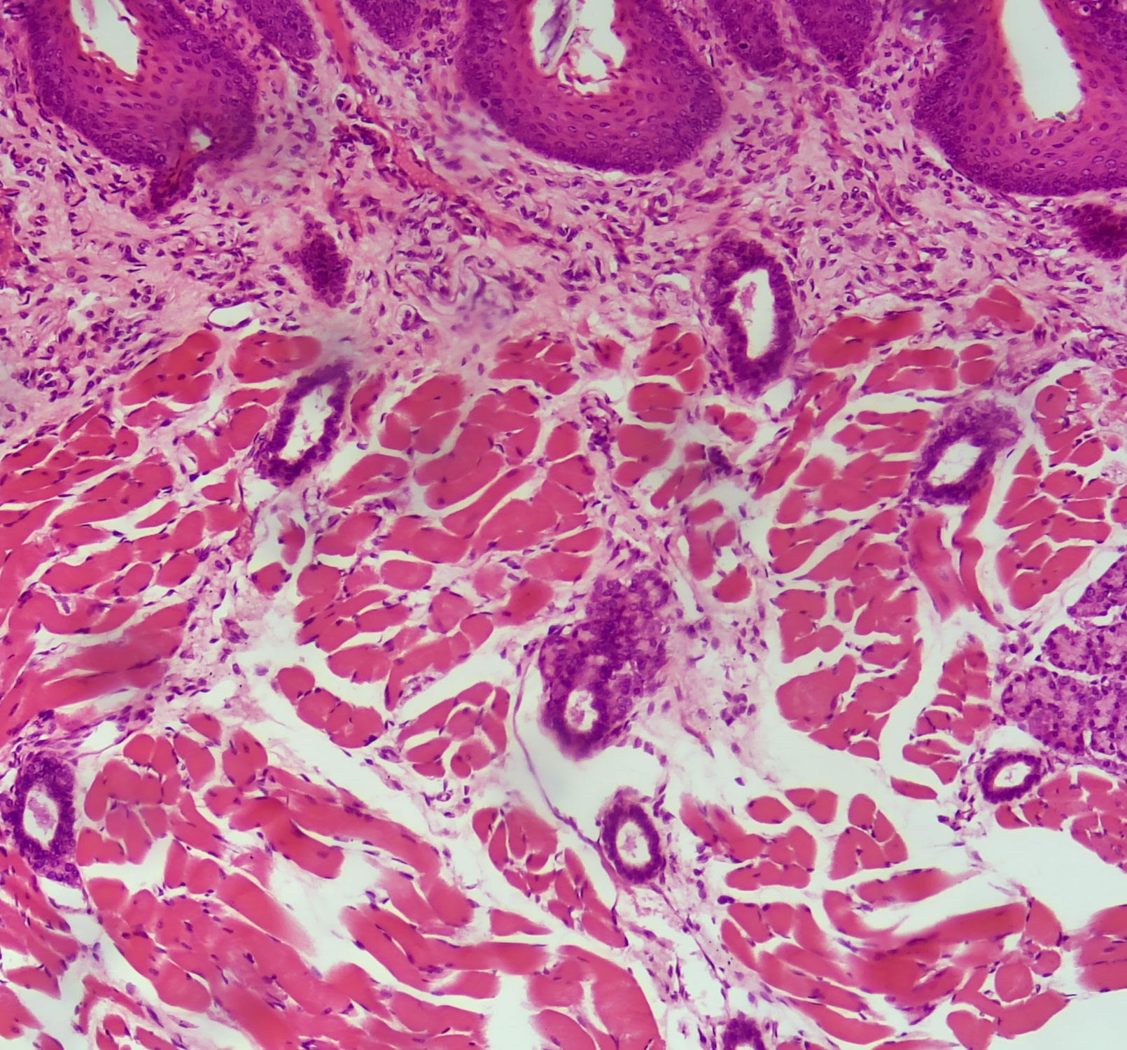 Brightfield Microscopes - Upright, Inverted, Microscopy Techniques ...